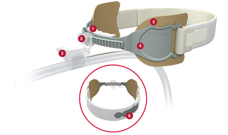 AnchorFast Oral Endotracheal Tube Fastener | Hollister NZ