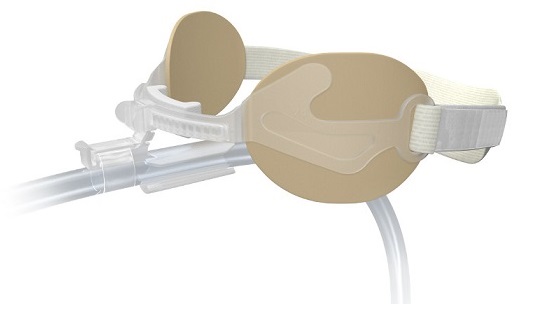 AnchorFast Oral Endotracheal Tube Fastener | Hollister NZ